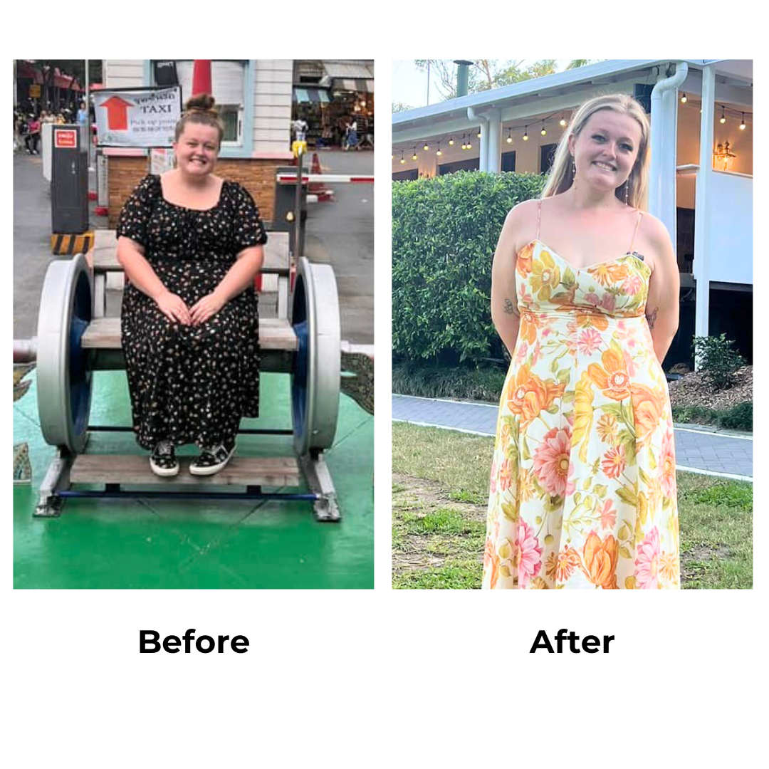 Ari lost 48 kg after Gastric Sleeve surgery in Thailand!