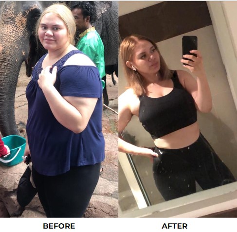 Kay had Gastric Sleeve Surgery in Thailand - Destination Beauty