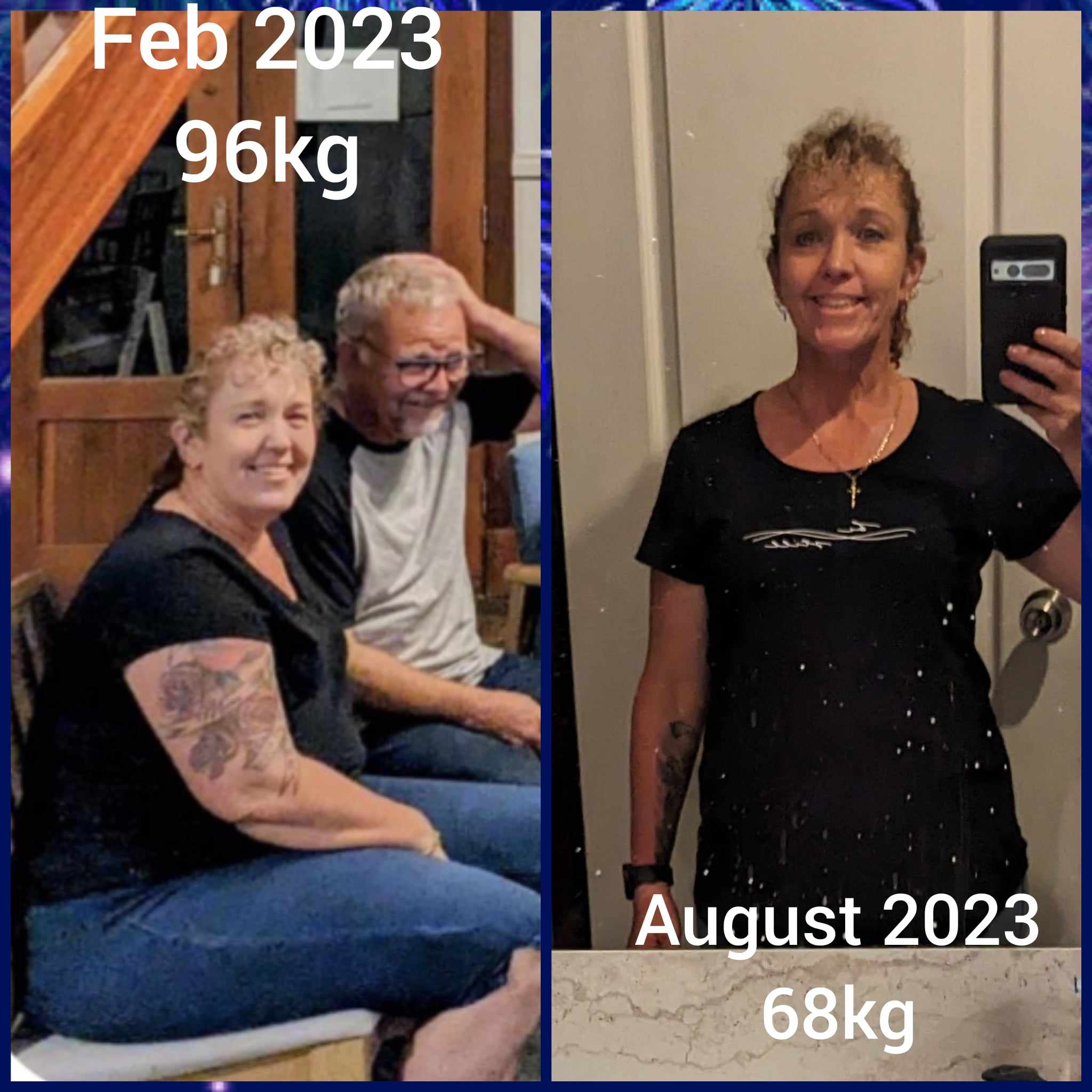 Tanya had a facelift and skin removal surgery in Thailand - Destination ...