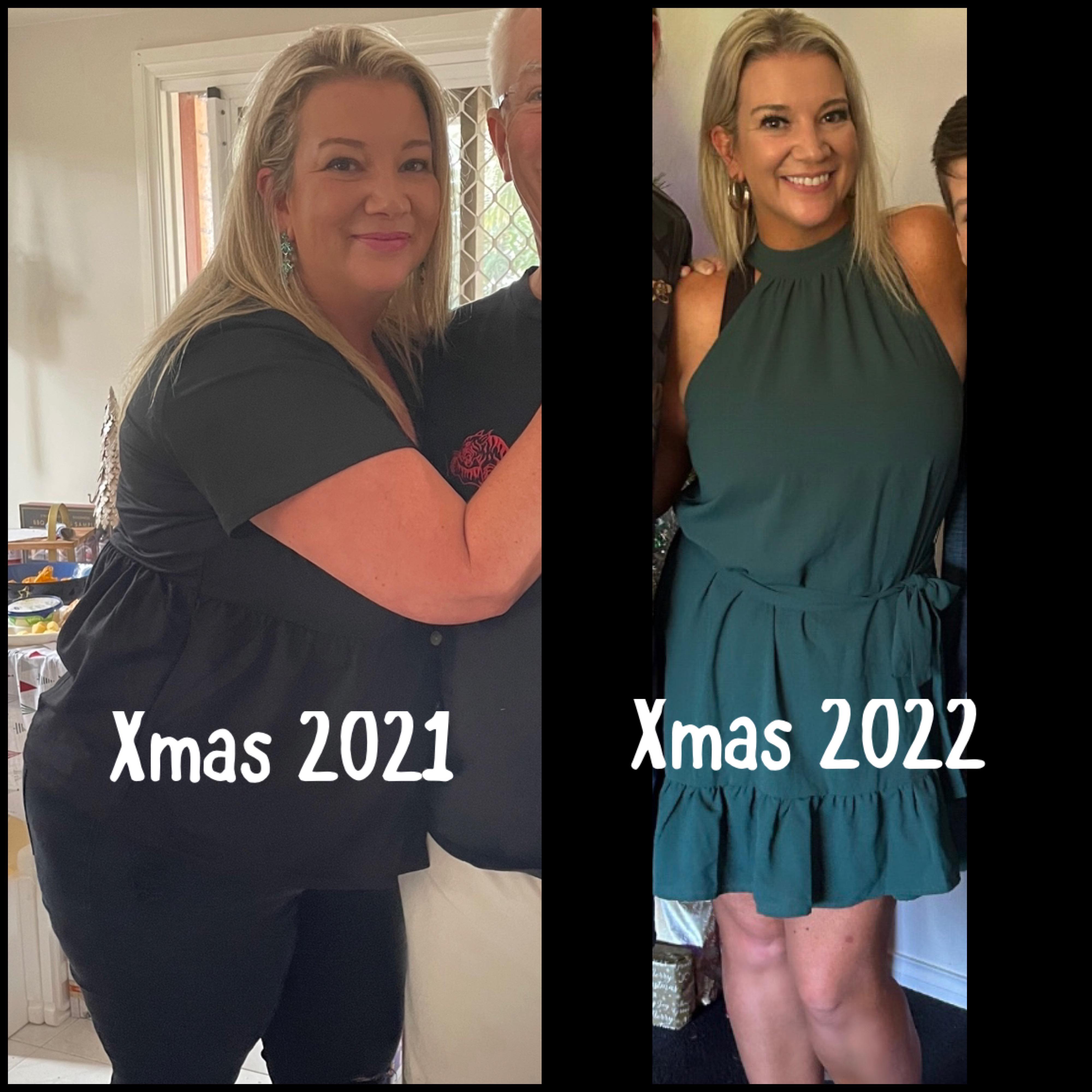 Amanda lost 37 KG after weight loss surgery!