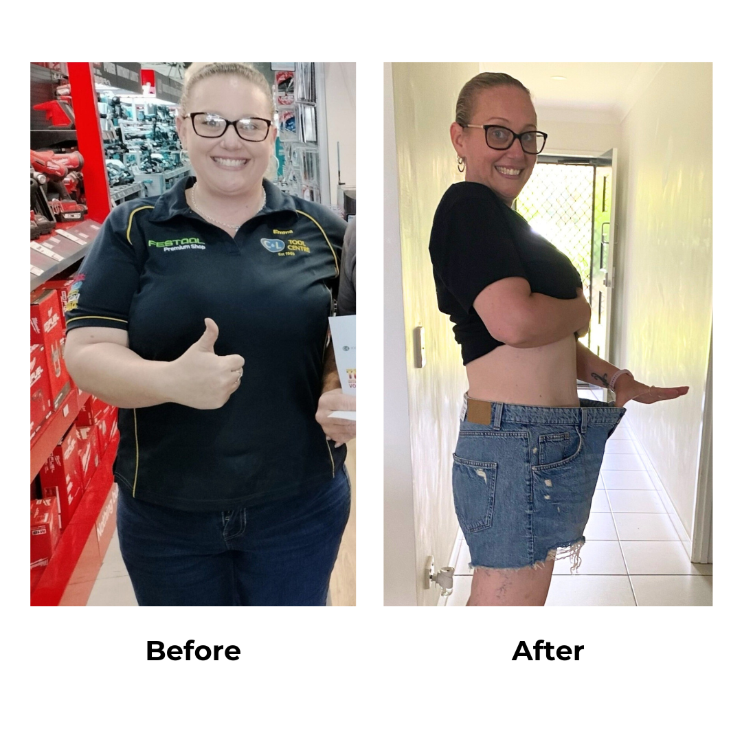 Emma lost 40 kg after weight loss surgery