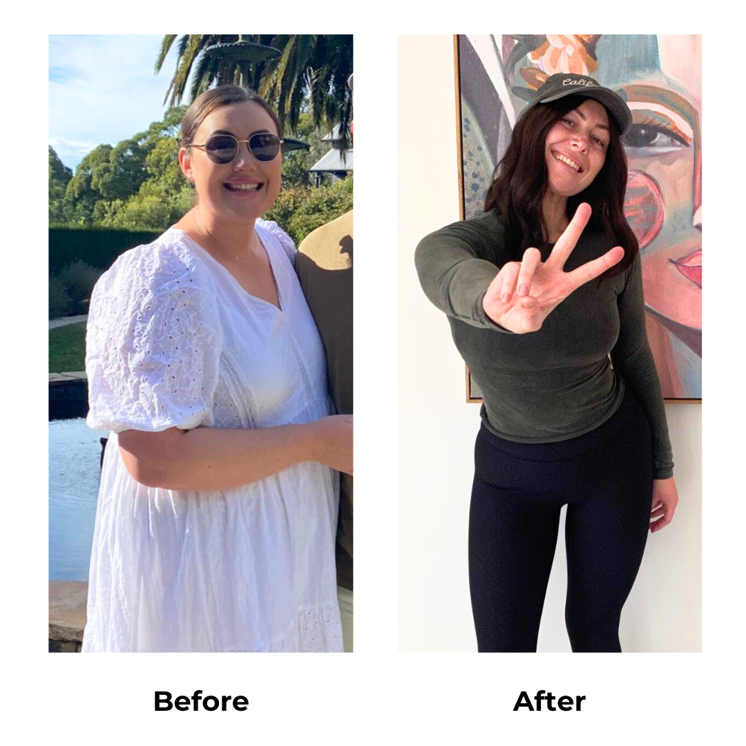 Georgia lost 45 kg after gastric sleeve surgery