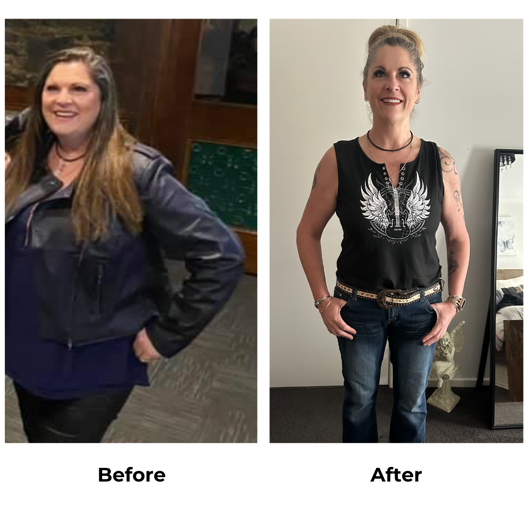 Sam lost 51 kg after gastric sleeve surgery